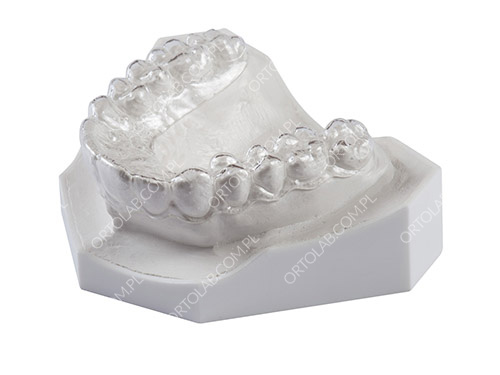 Orthodontics - OrthoDental.co.uk